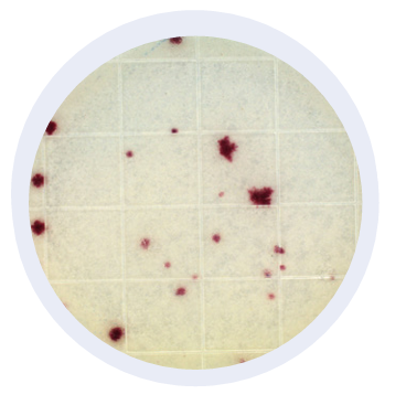 Peel Plate Microbial Tests